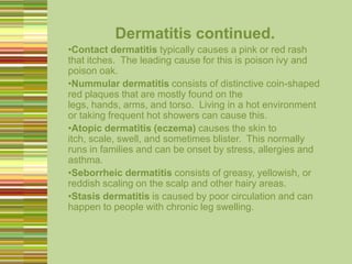 Integumentary system presentation | PPT