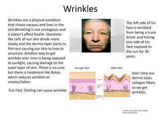 Integumentary system student reports | PPTX