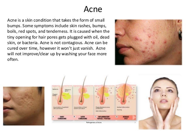 Integumentary system student reports