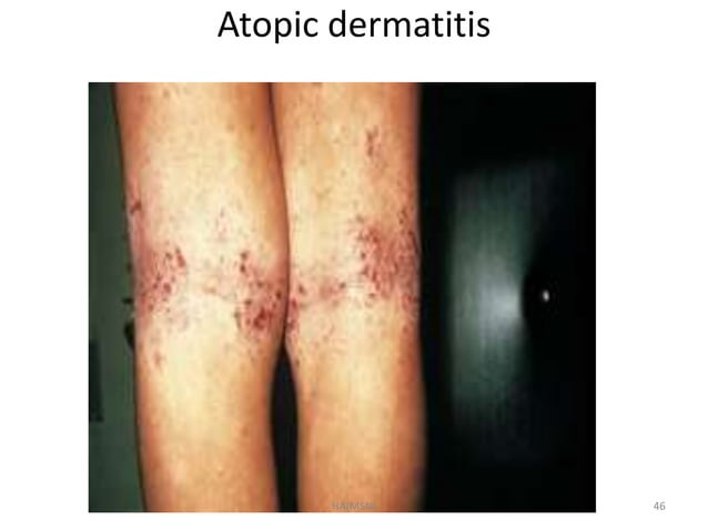 Integumentary Disorders Presentation.ppt