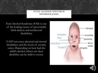 Intellectual disabilities PPS 6009 | PPTX