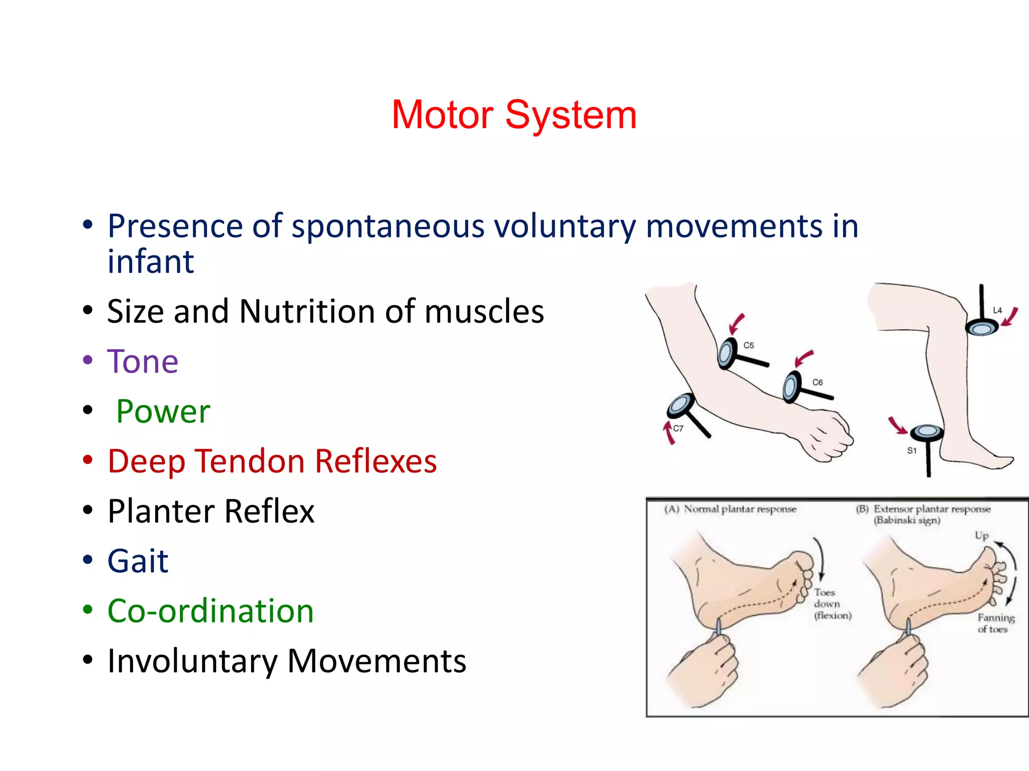 Intellectual disability in children 2021 | PDF