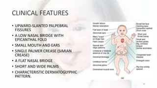 INTELLECTUAL DISABILITY PART- I | PPT