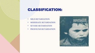 INTELLECTUAL DISABILITY -CLASSIFICATION, SIGN AND PREVENTION, ppt ...