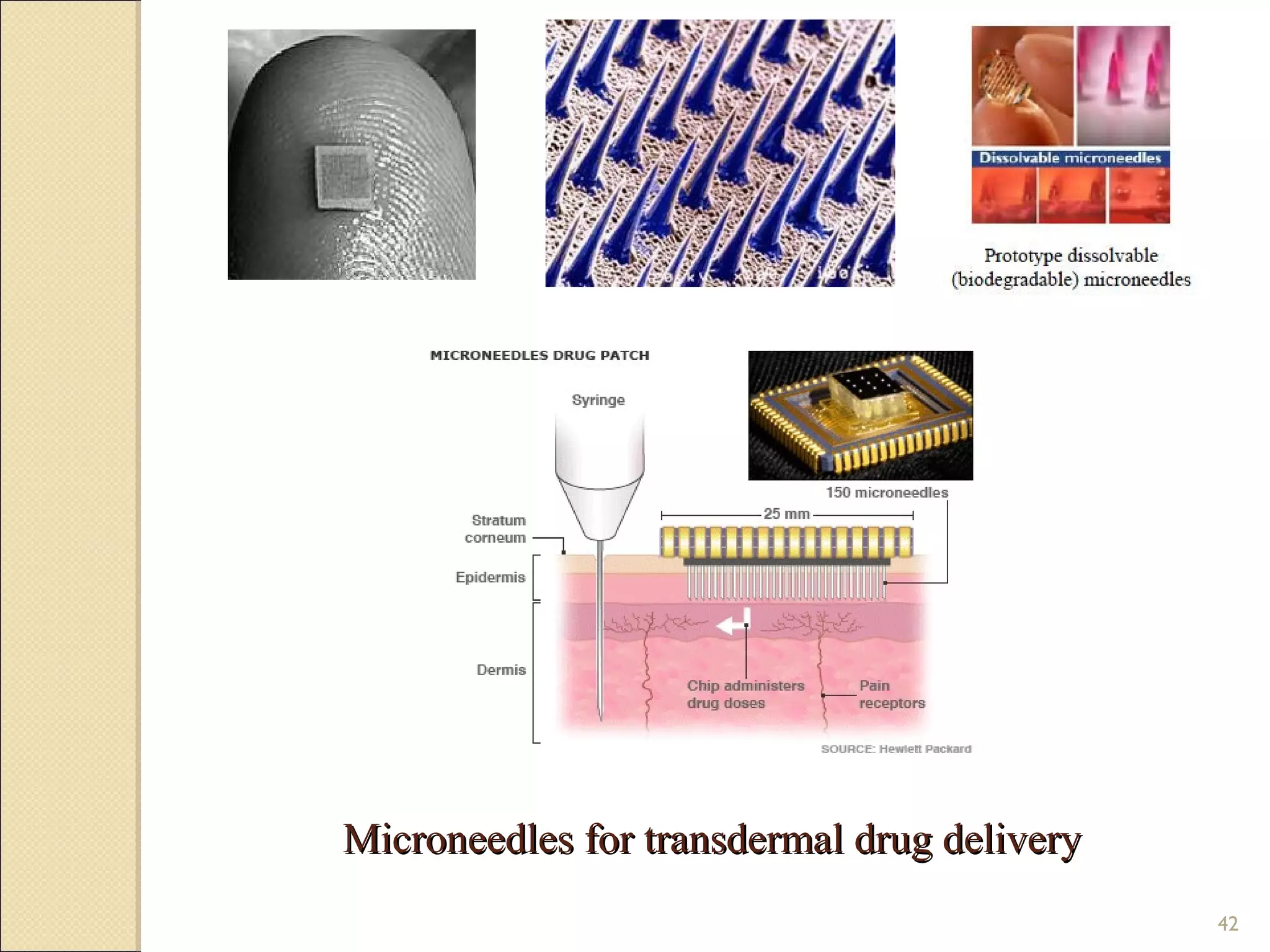 Intelligent drug delivery system | PPT