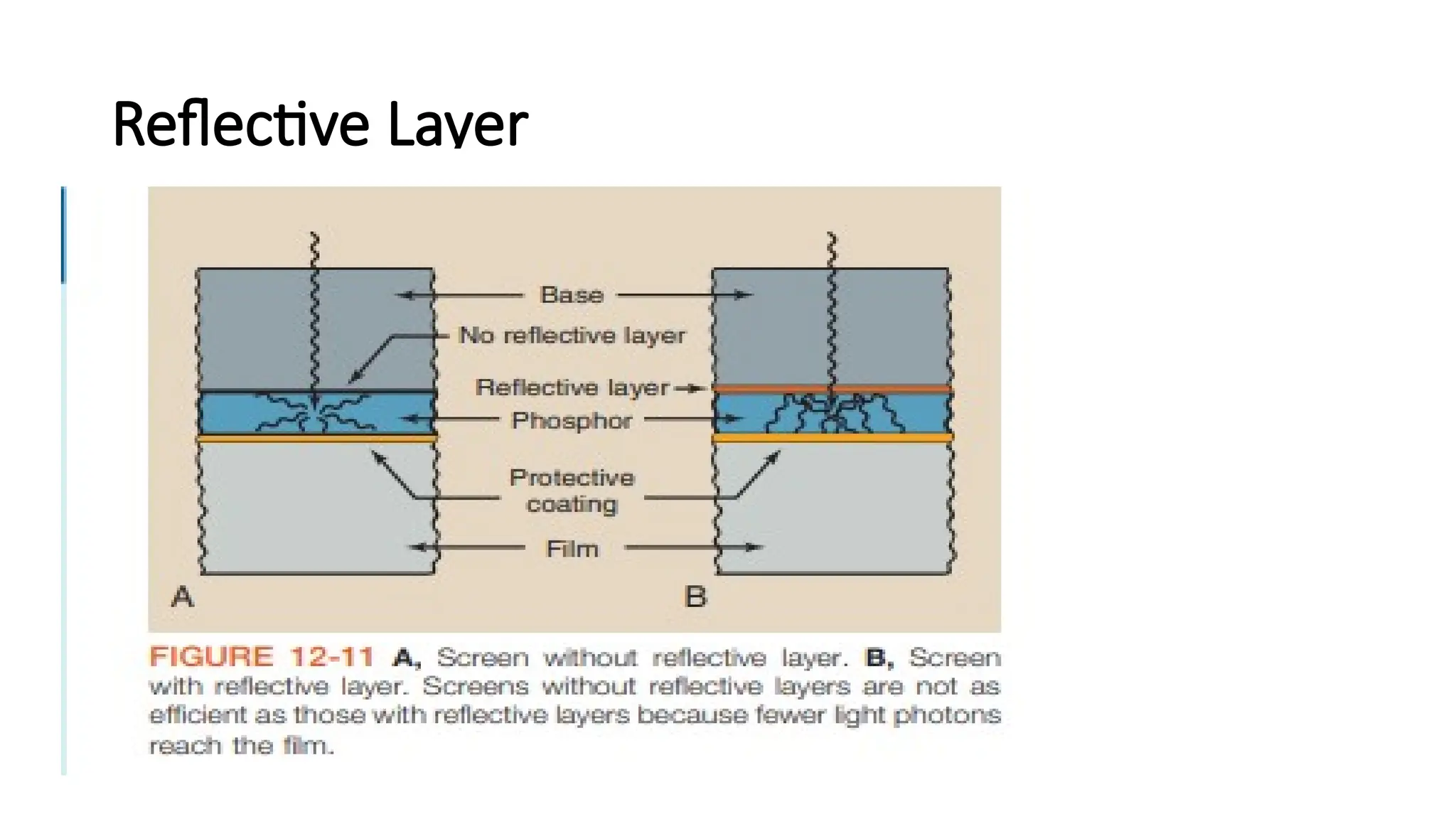intensifying screen and its types by T.R.B. | PPTX