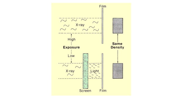 intensifying screen and its types by T.R.B. | PPTX