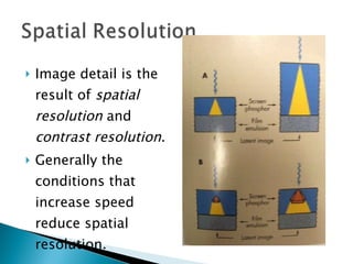 Intensifying screens | PPT
