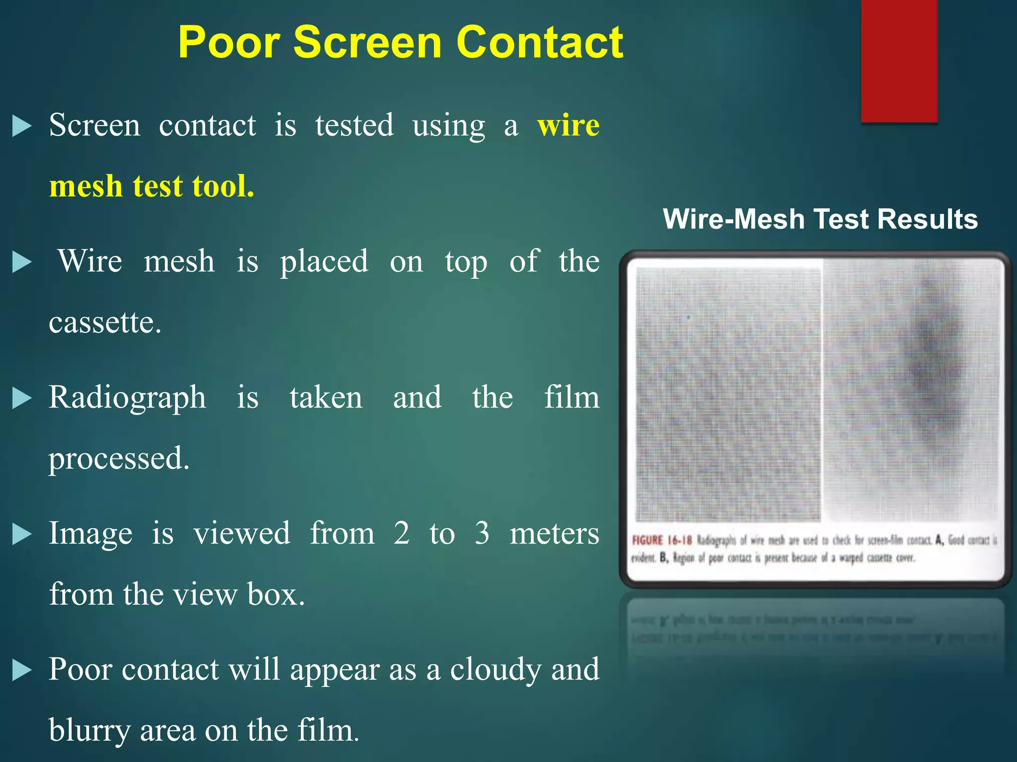 intensifying screens and grids.pptx