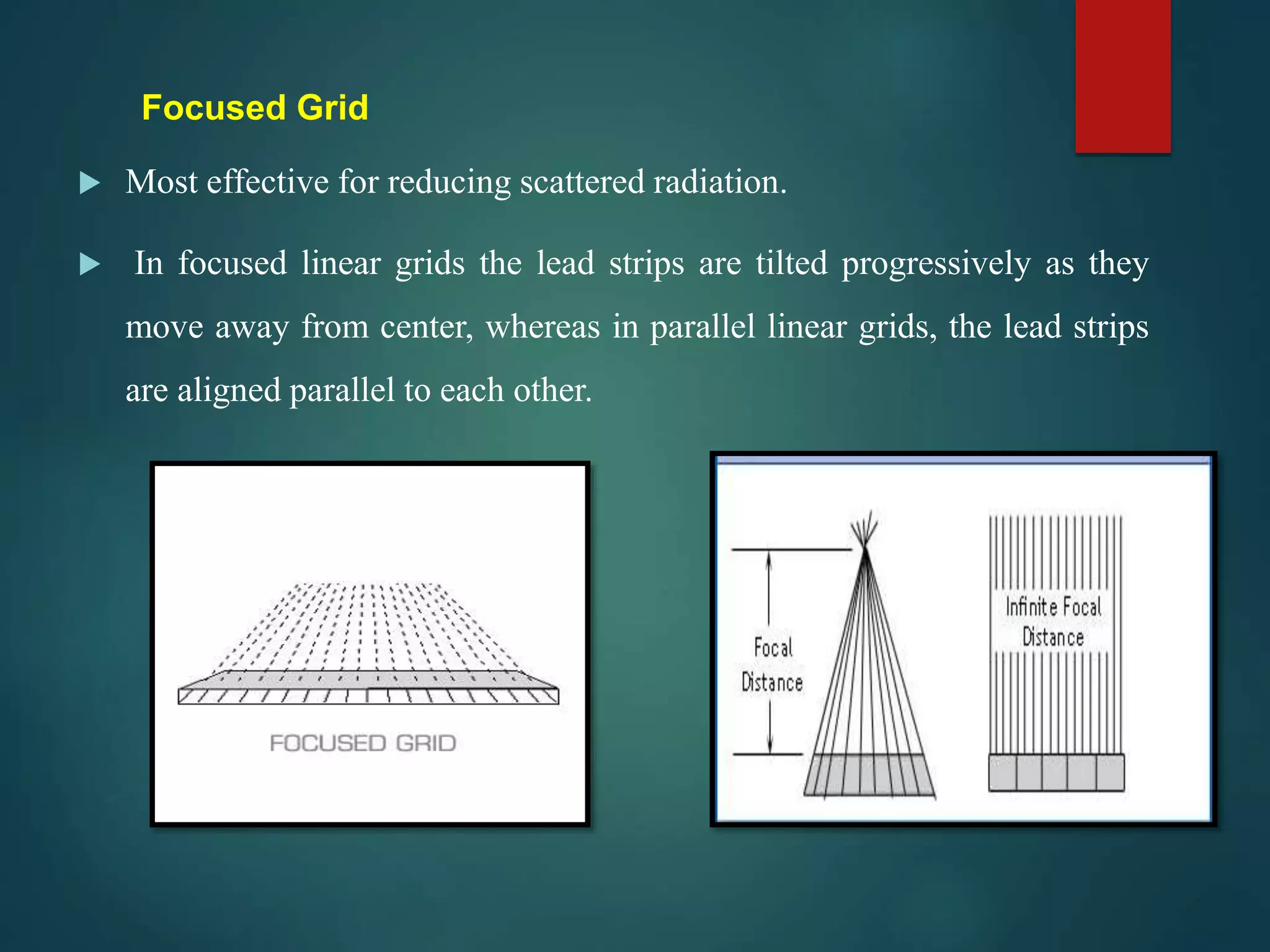 intensifying screens and grids.pptx