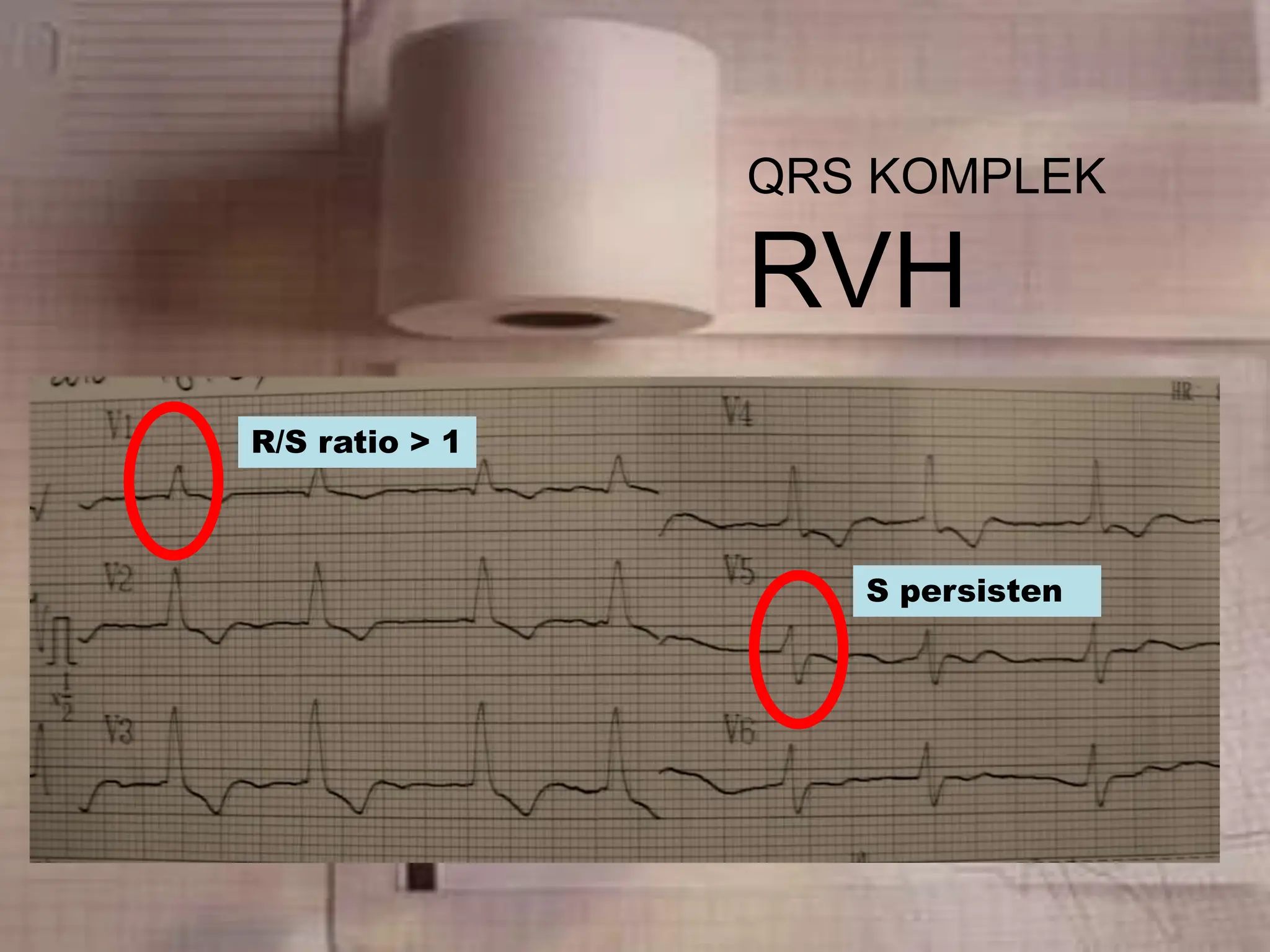 Intepretasi EKG Modul Kardiorespirasi.pptx