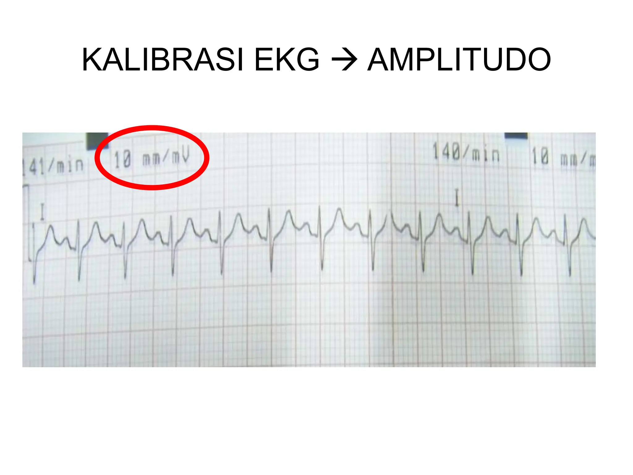 Intepretasi EKG Modul Kardiorespirasi.pptx