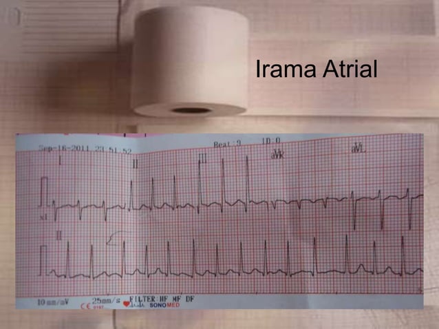 Intepretasi EKG Modul Kardiorespirasi.pptx