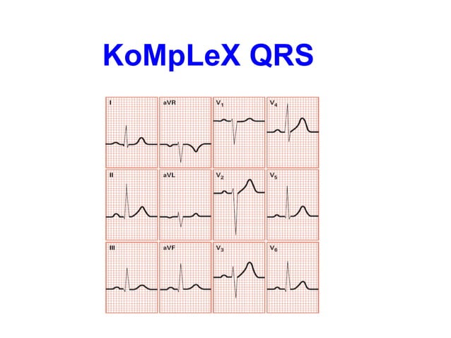Intepretasi EKG Modul Kardiorespirasi.pptx