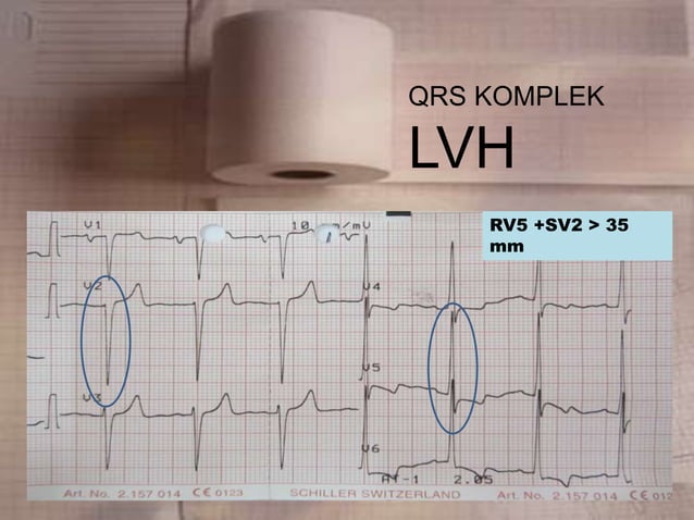 Intepretasi EKG Modul Kardiorespirasi.pptx