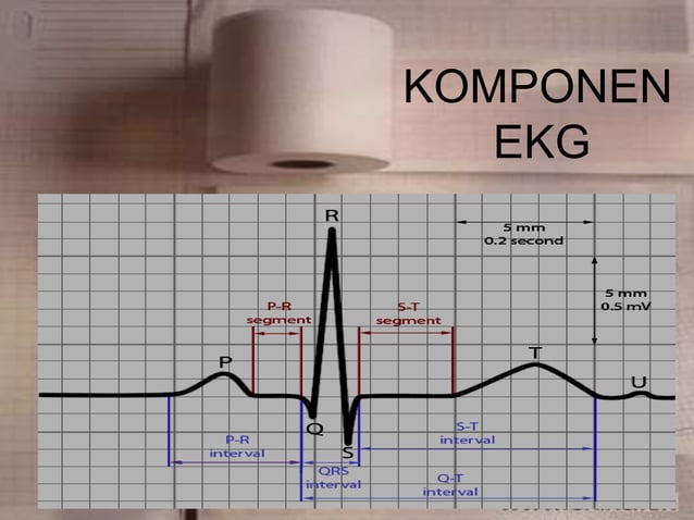 Intepretasi EKG Modul Kardiorespirasi.pptx