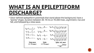 Inter-ictal epileptiform abnormalities.pptx