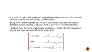 Inter-ictal epileptiform abnormalities.pptx