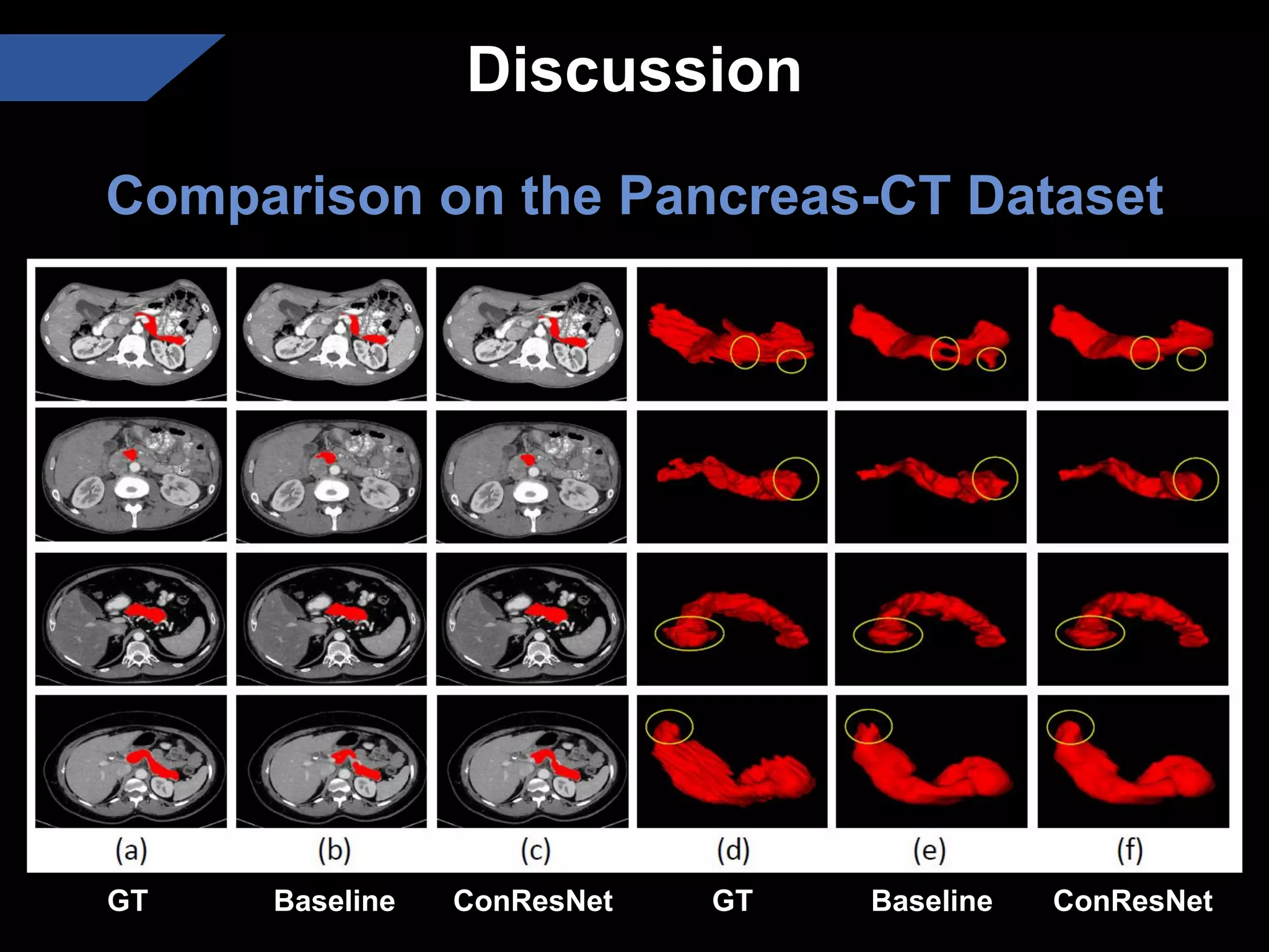 Review : Inter-slice Context Residual Learning for 3D Medical Image Segmentation | PPT