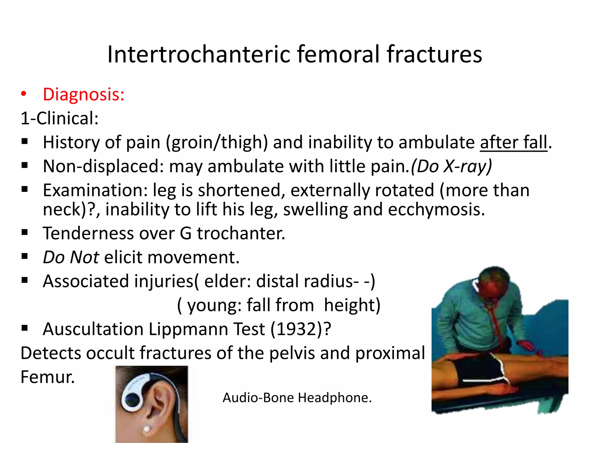 Inter trochanteric femoral fractures | PPTX