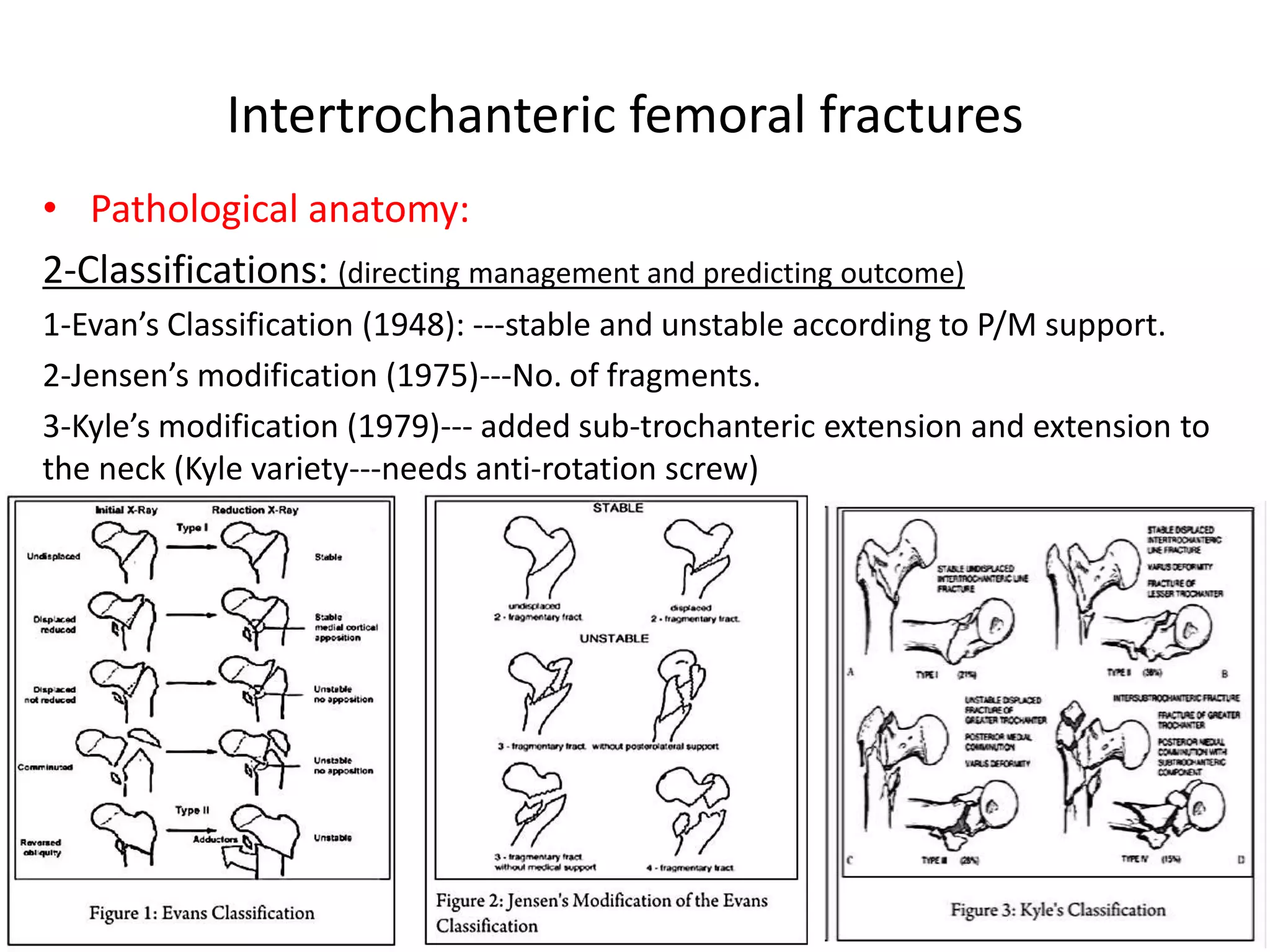 Inter trochanteric femoral fractures | PPTX