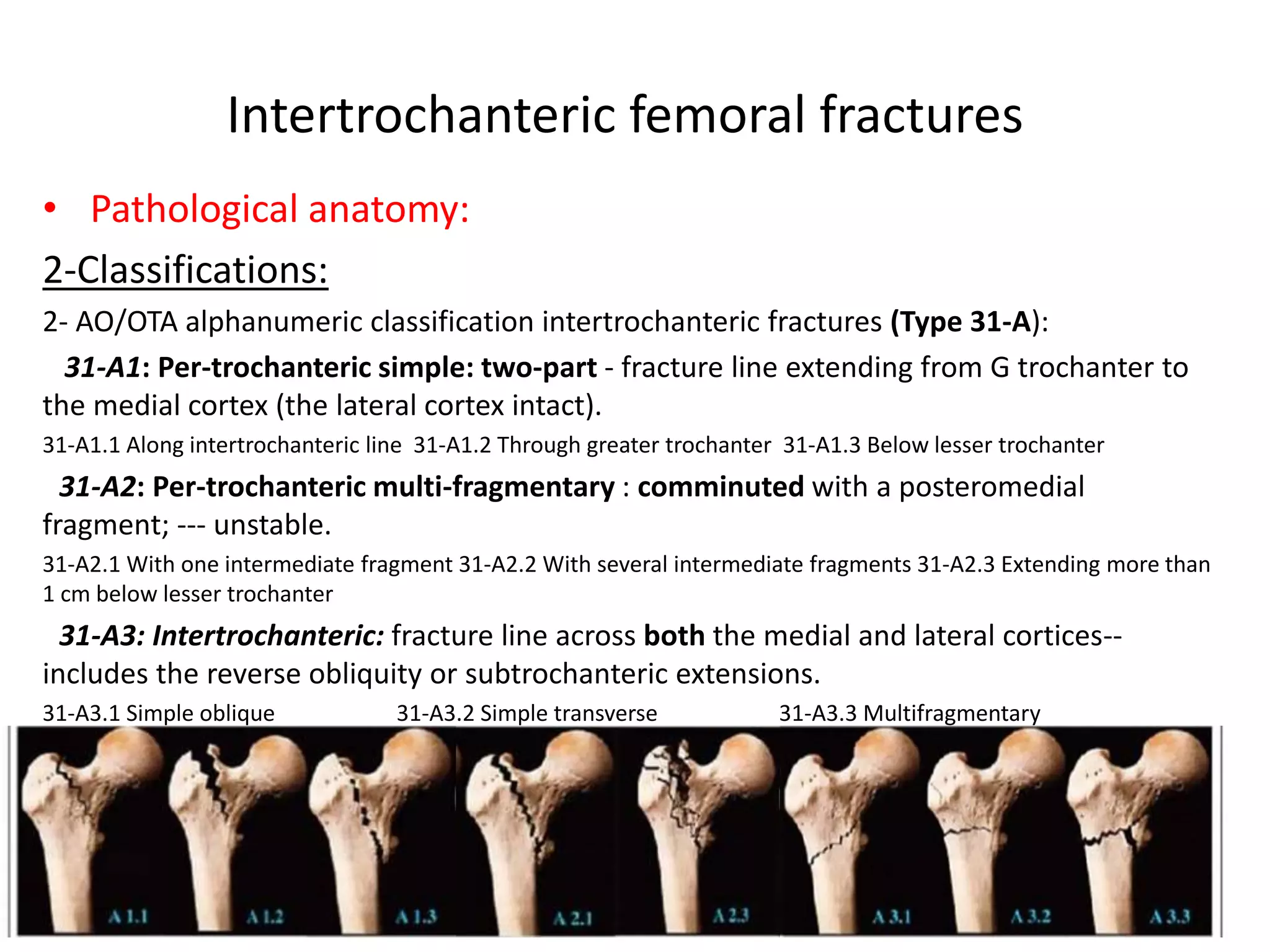 Inter trochanteric femoral fractures | PPTX