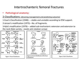 Inter trochanteric femoral fractures | PPTX