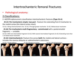Inter trochanteric femoral fractures | PPTX