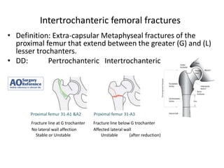 Pertrochanteric Fracture