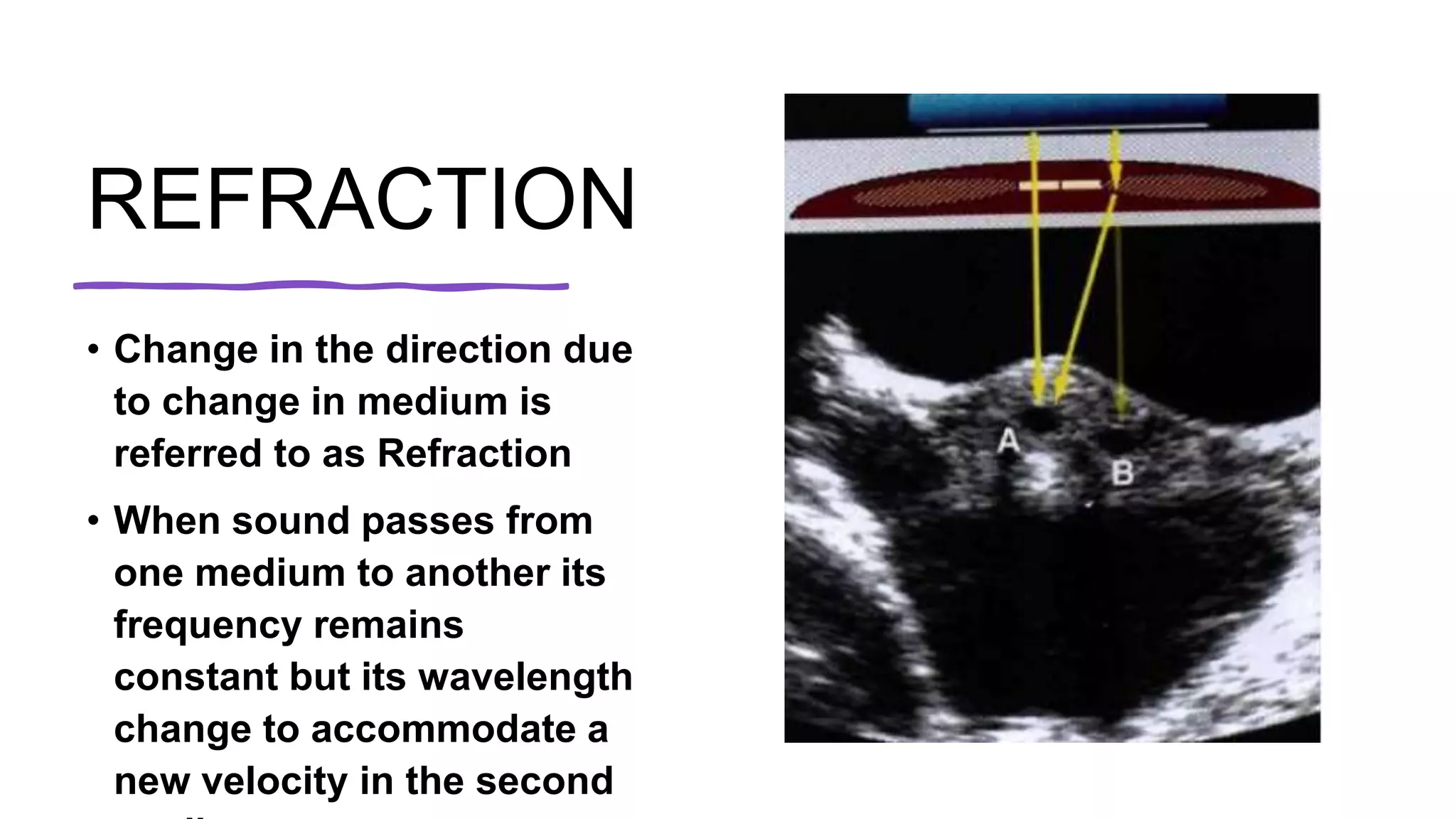 Interactions of ultrasound with matter | PPTX