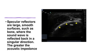 Specular Reflection Ultrasound