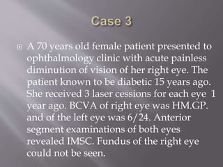 interactive retina and orbit.pptx