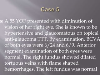 interactive retina and orbit.pptx
