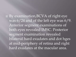 interactive retina and orbit.pptx