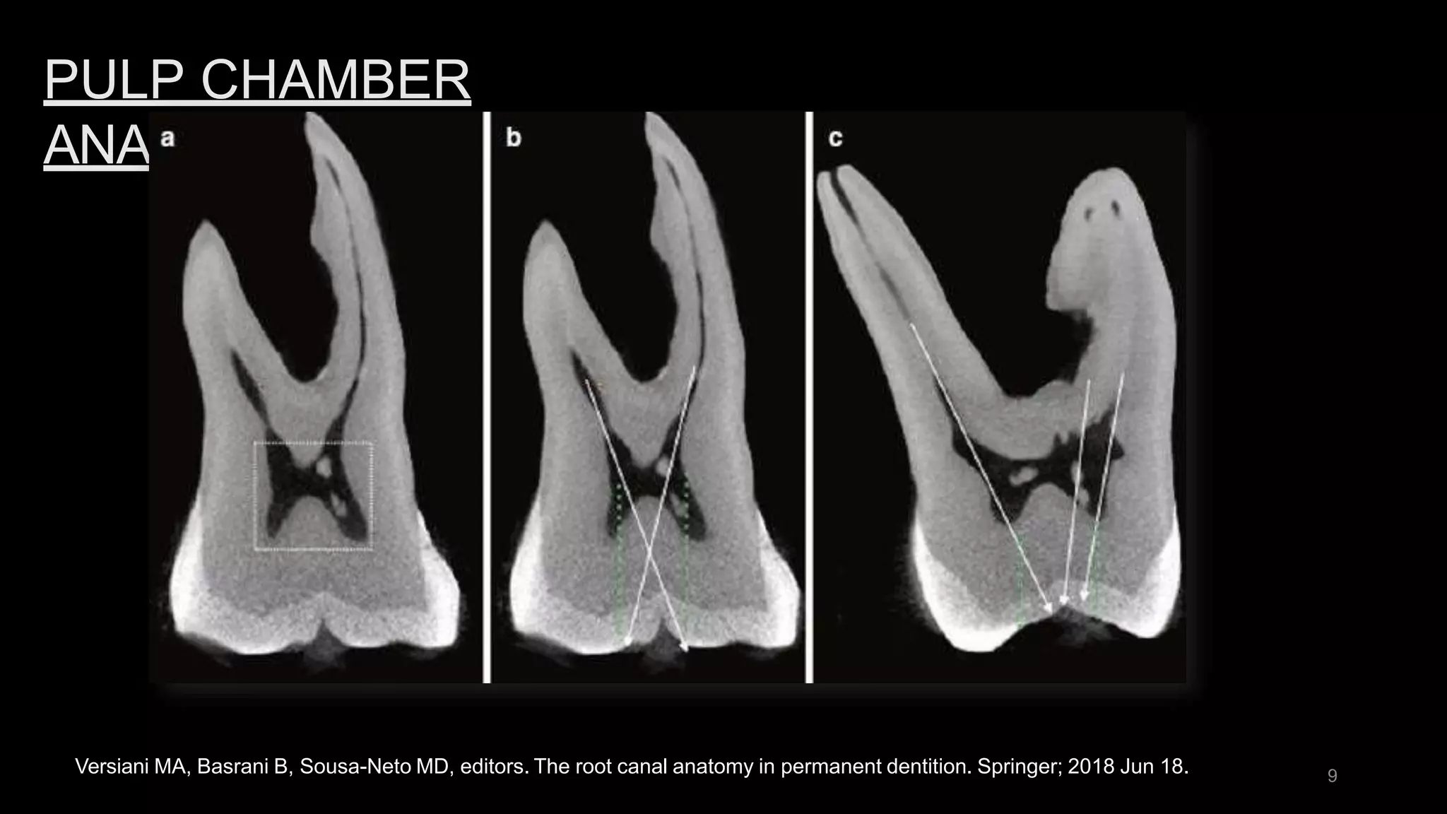 interanal anatomy 1.pptx