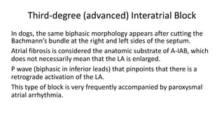 Interatrial Block (IAB) | PPT