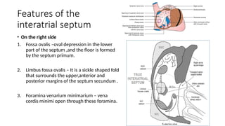 Interatrial Septum Embryology Ias Anatomy Pptx
