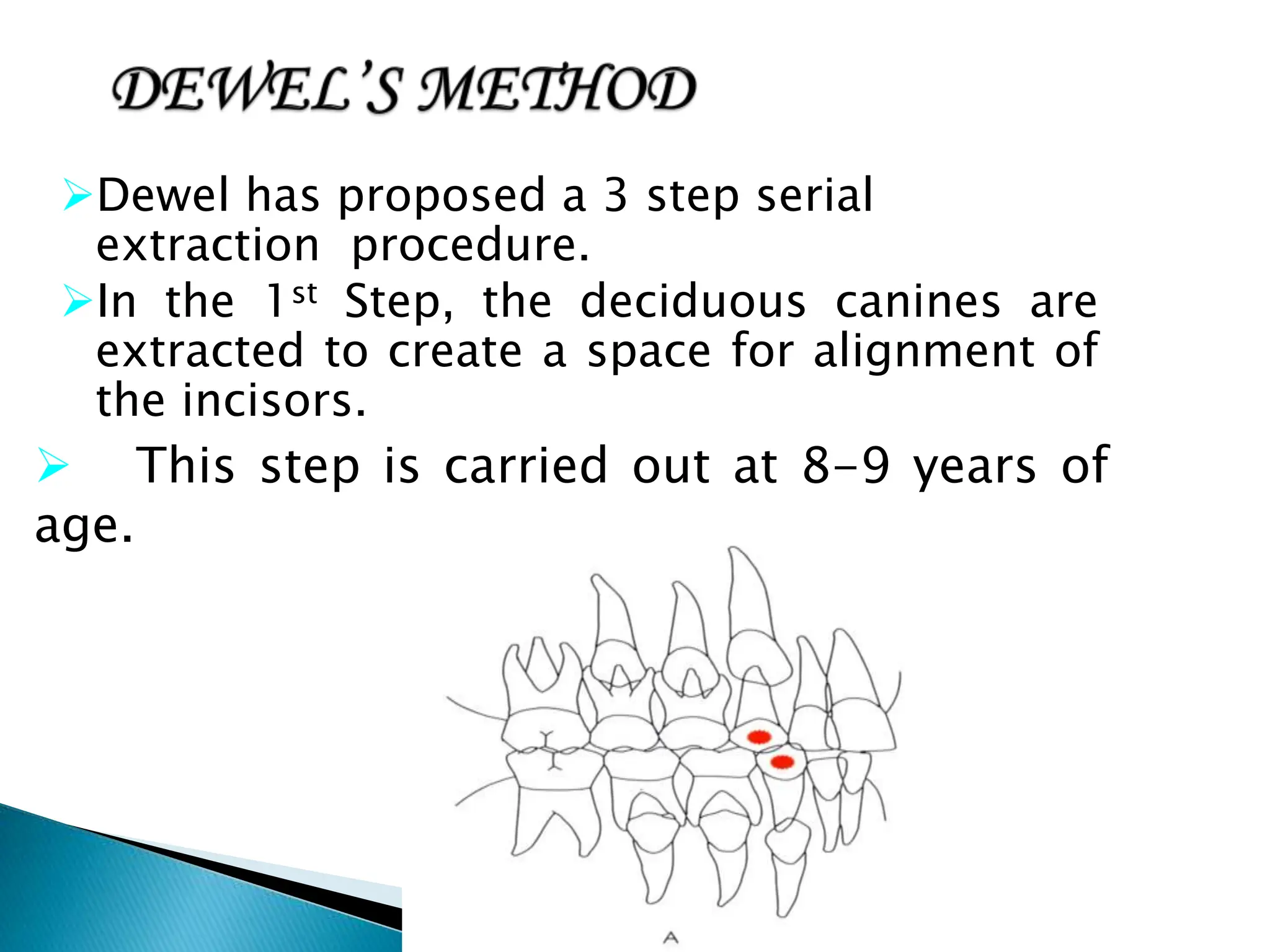 interceptive final.pptx