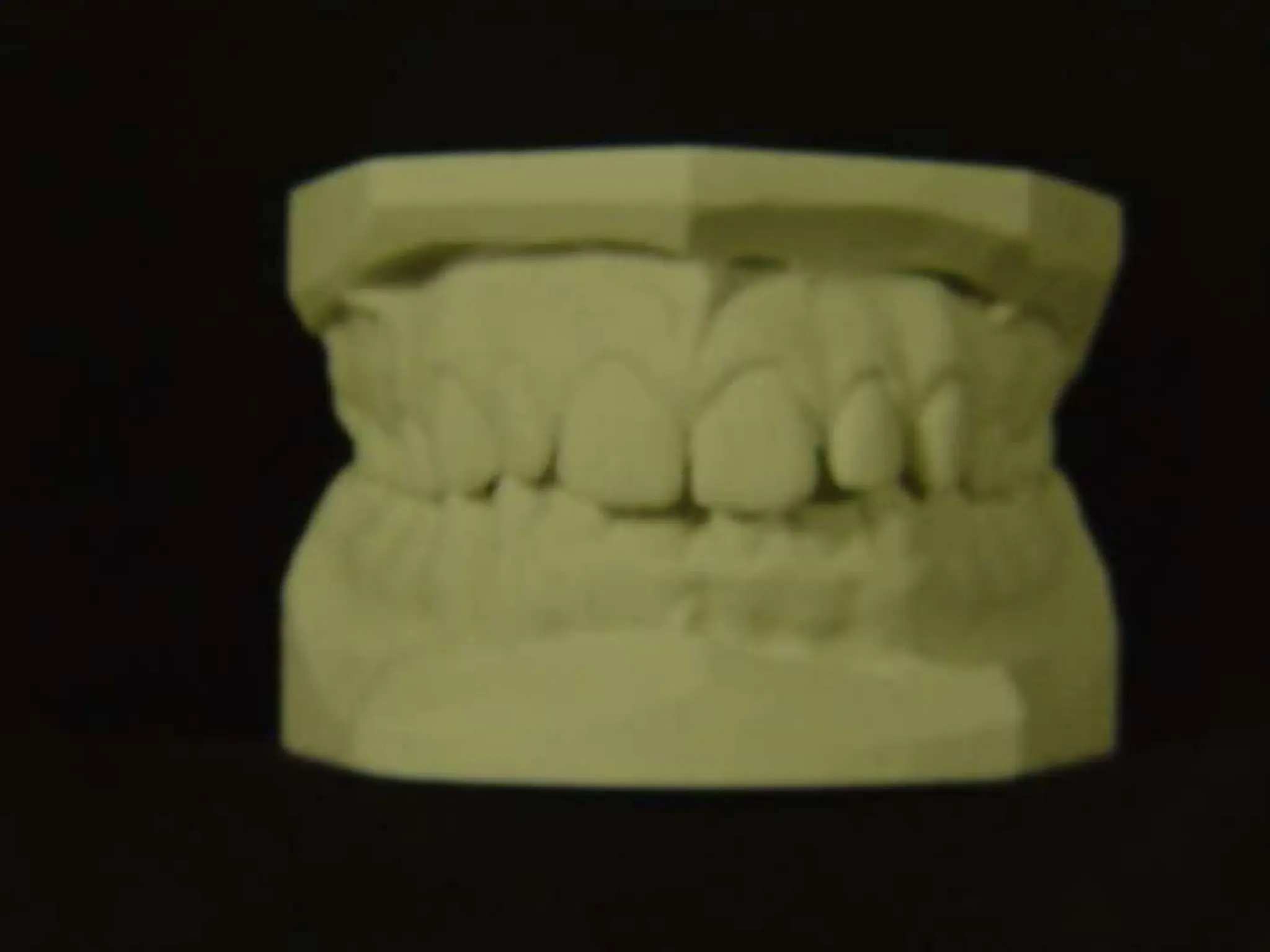 interceptive final.pptx