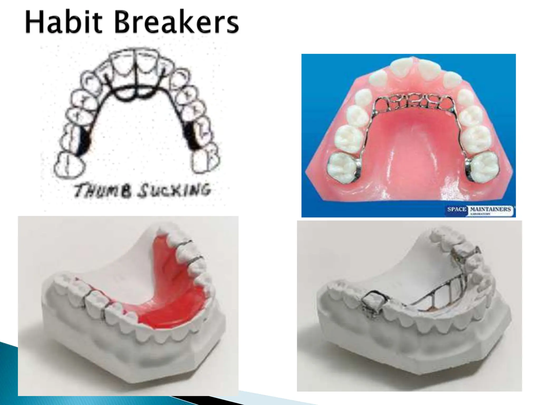 interceptive final.pptx