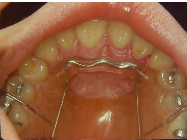 interceptive final.pptx