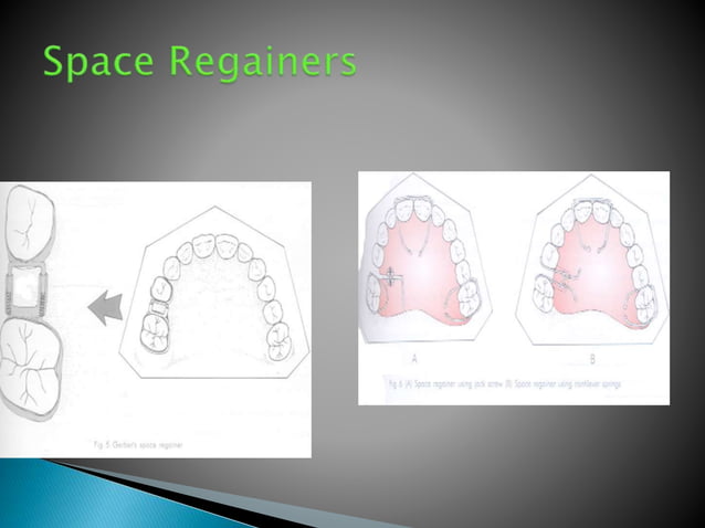interceptive final.pptx