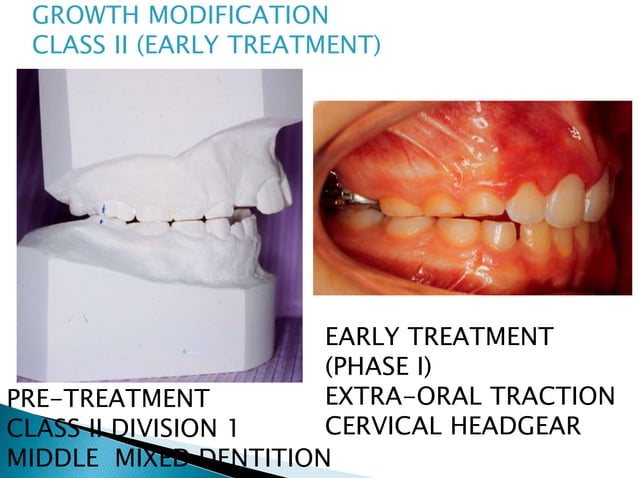 interceptive final.pptx