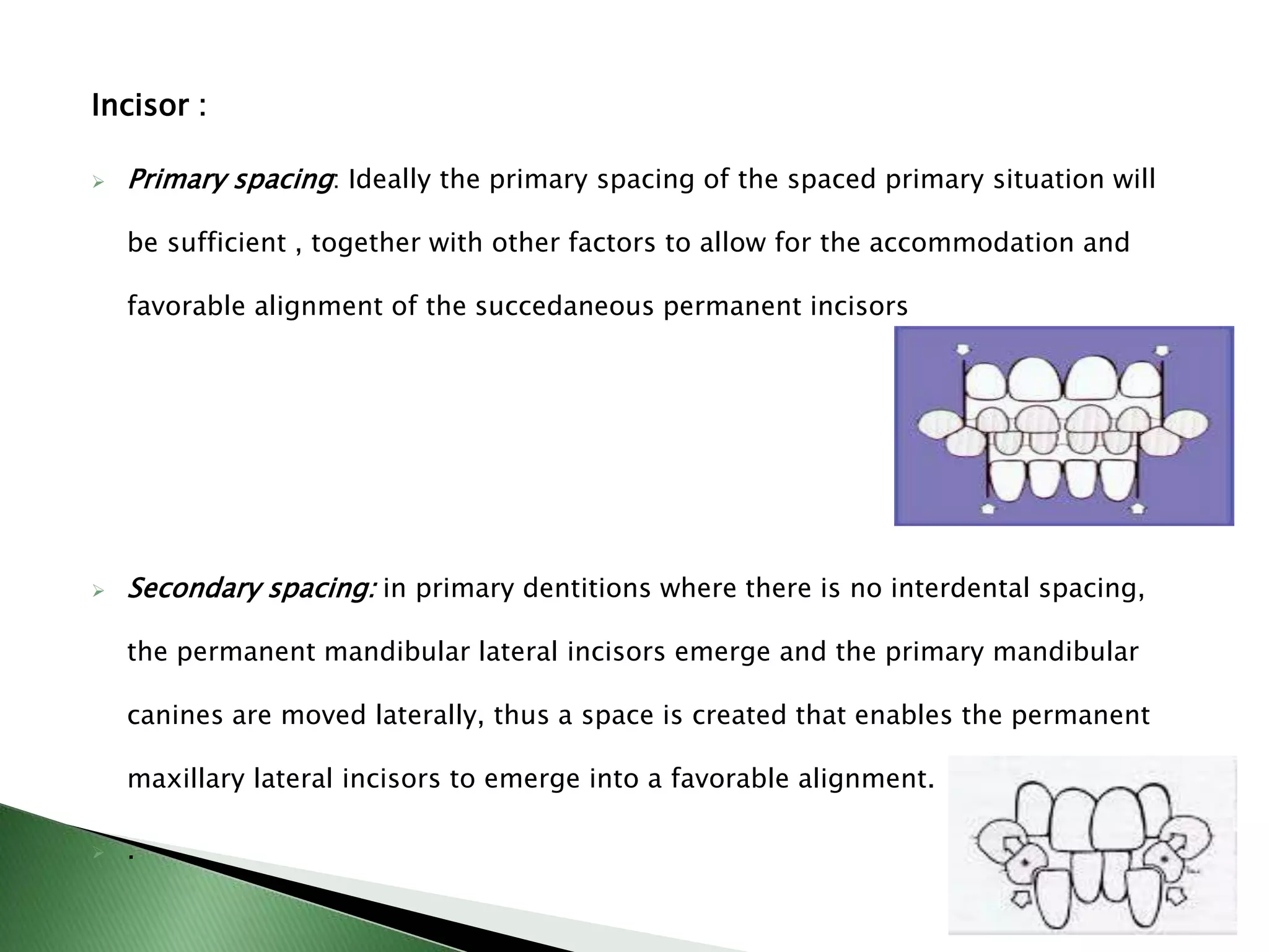Interceptive guidance of occlusion with emphasis on diagnosis | PPTX