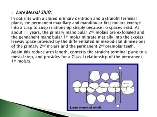 Interceptive guidance of occlusion with emphasis on diagnosis | PPTX