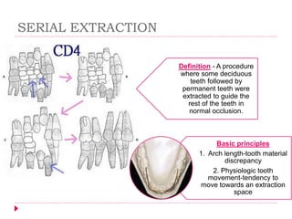 Interceptive orthodontics | PPTX