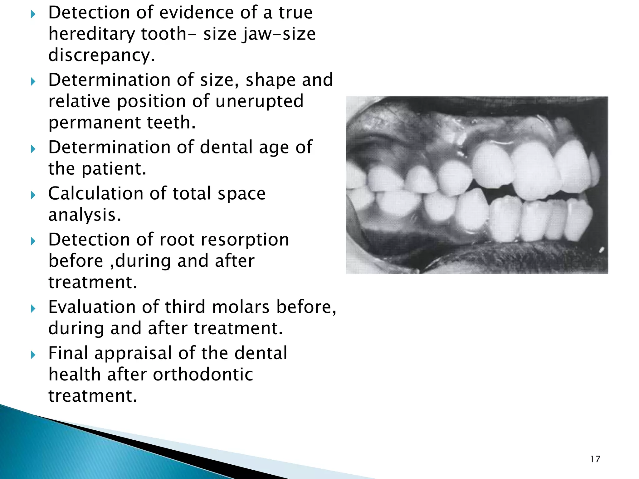 Interceptive orthodontics | PPTX