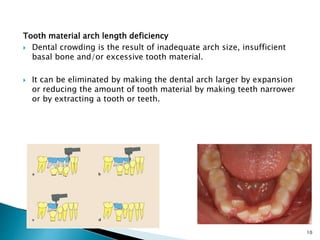 Interceptive orthodontics | PPTX