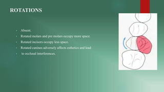 INTERCEPTIVE ORTHODONTICS.pptx