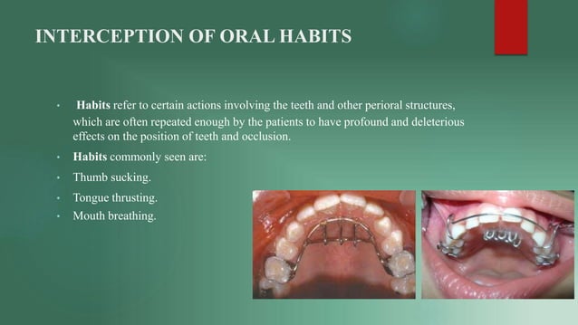 INTERCEPTIVE ORTHODONTICS.pptx | Dental Health | Diseases and Conditions